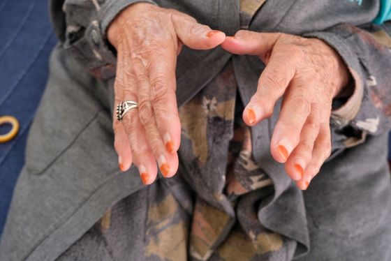 Reumatism articular acut – informatii despre cauze si tratament